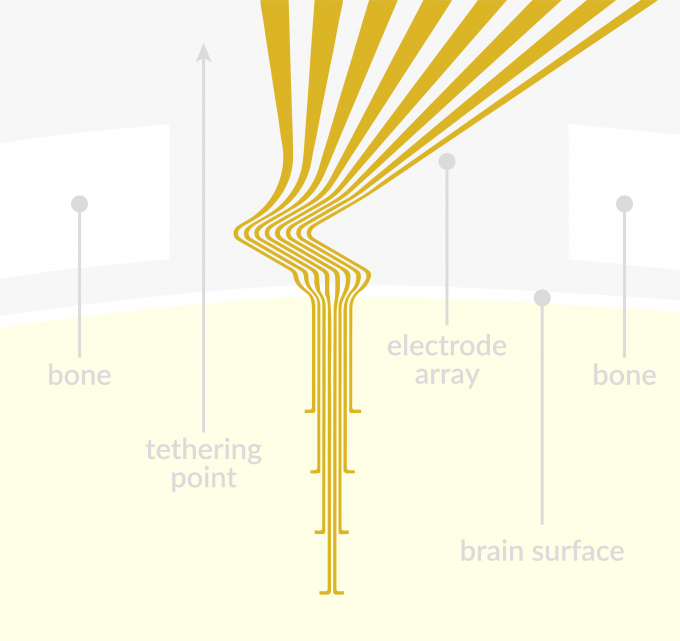 Breakthrough for flexible electrode implants in the brain « the ...
